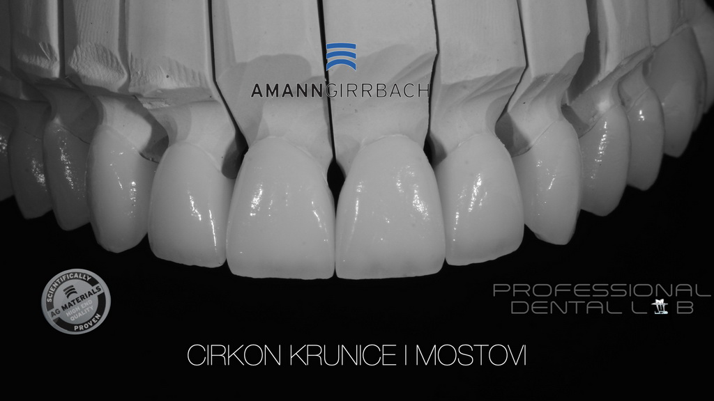 Cirkon krunice i mostovi - MT Lab